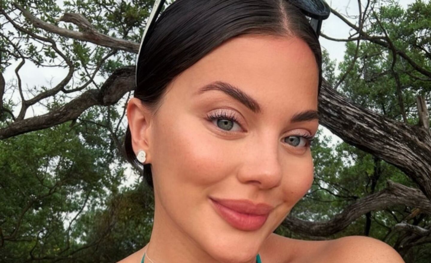 Laura Ortega se sometió a un nuevo tratamiento estético | La Teja