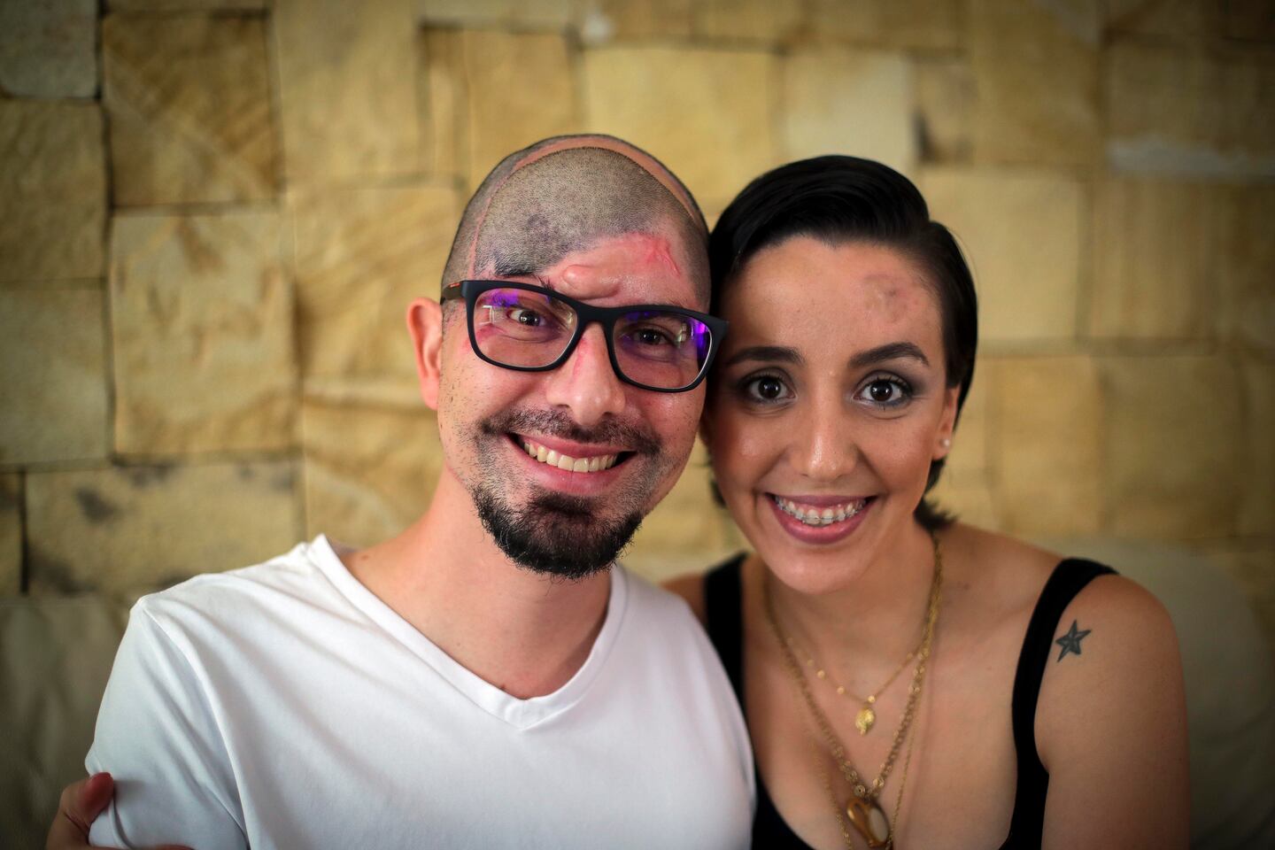 Alex y Rebe usan su experiencia para llevar luz a personas que sufren ...