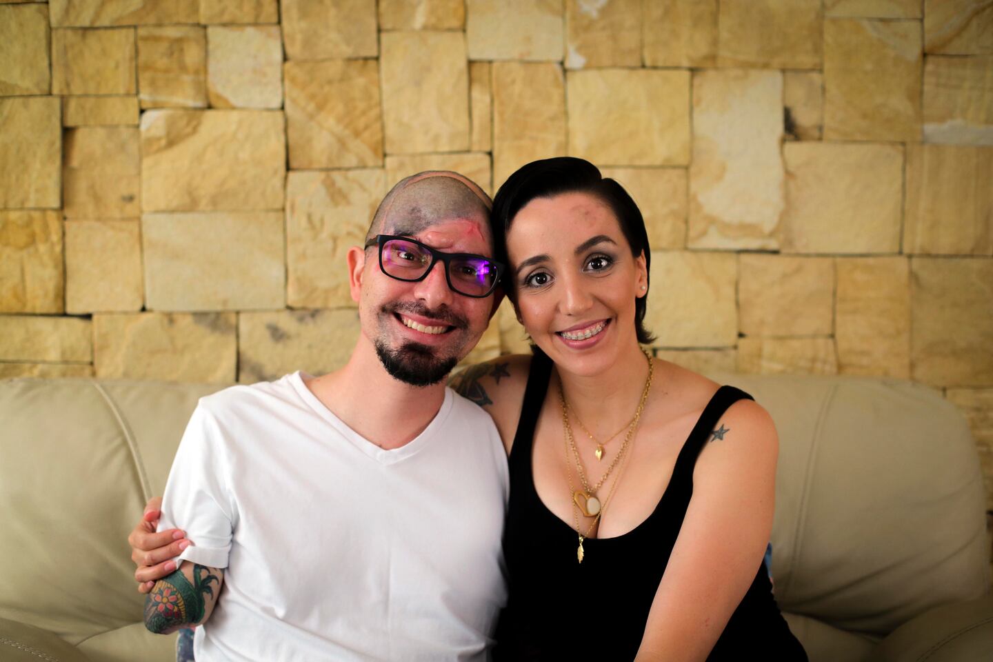 Video: Alex y Rebe, el renacer tras el accidente que casi les cuesta la ...