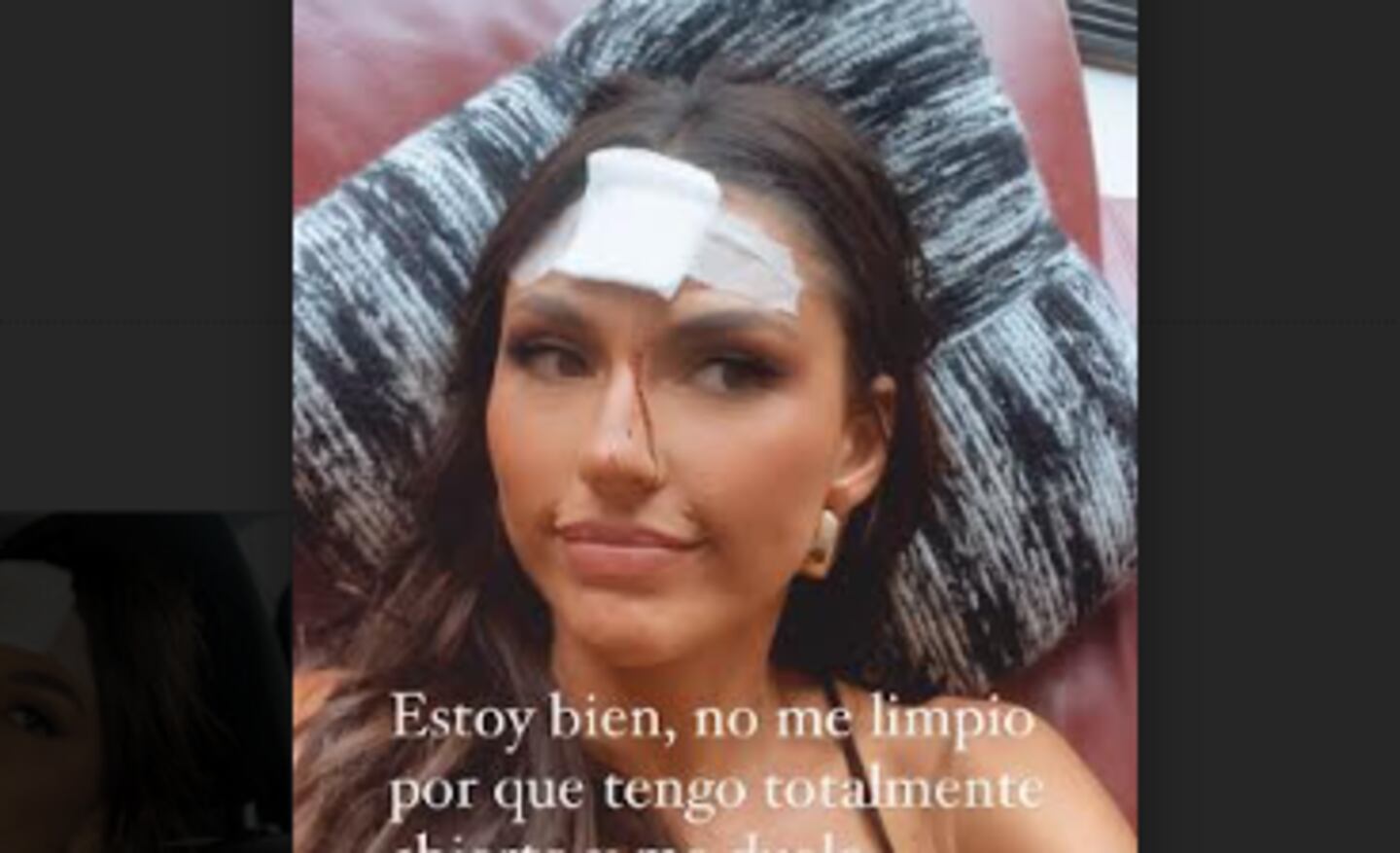 Miss Costa Rica Valeria Rees se rompió la frente al pegar contra el ...